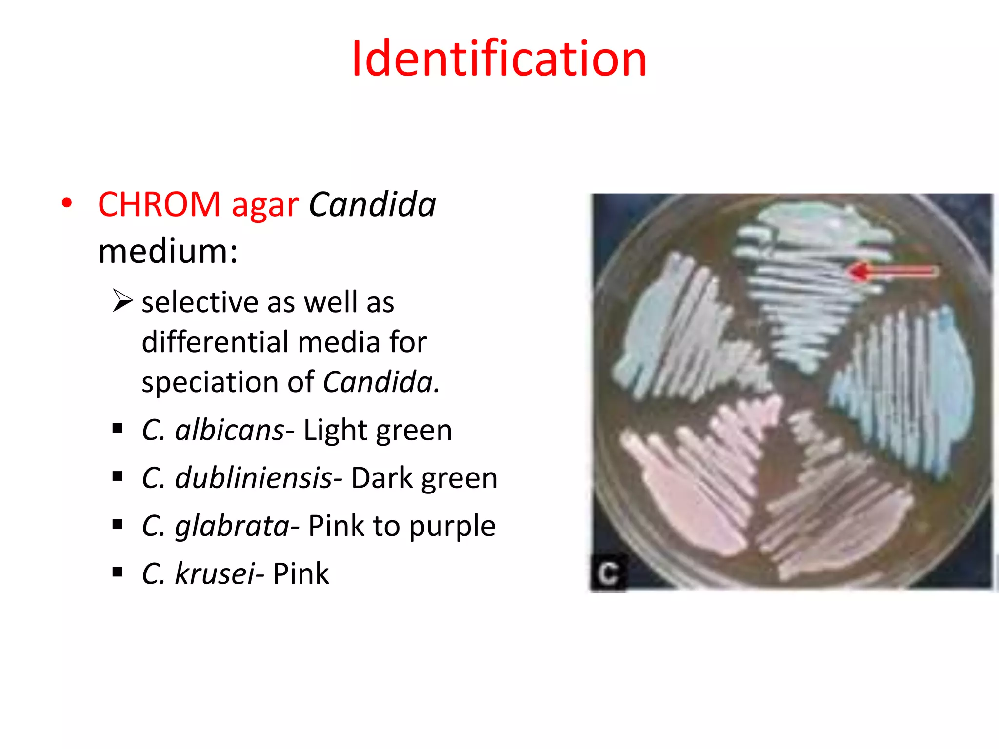 Fungal diagnosis | PPTX