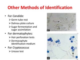 Fungal diagnosis | PPTX