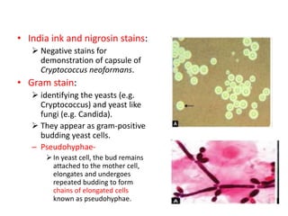 Fungal diagnosis | PPTX