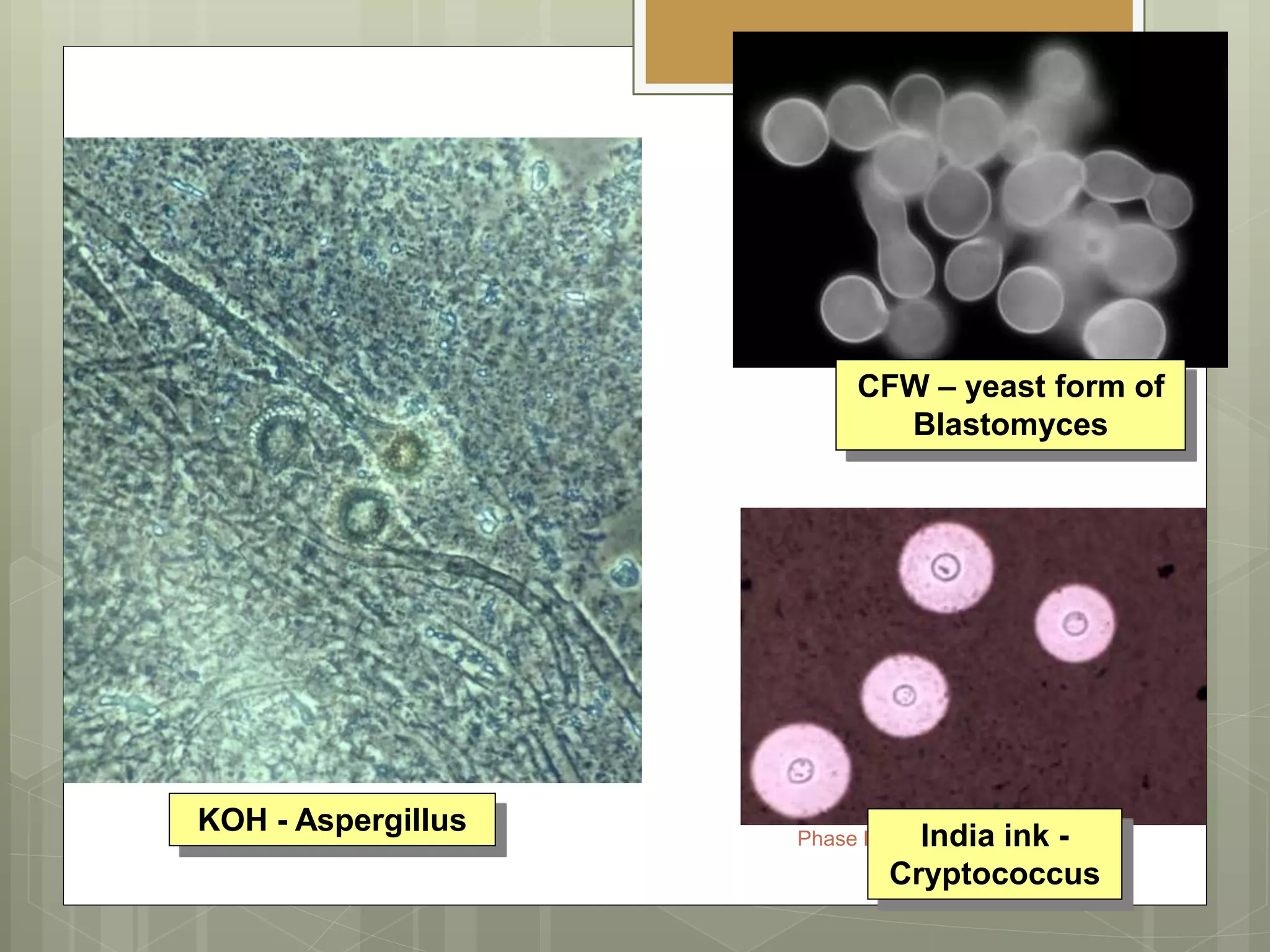 fungal diagnosis.pptx