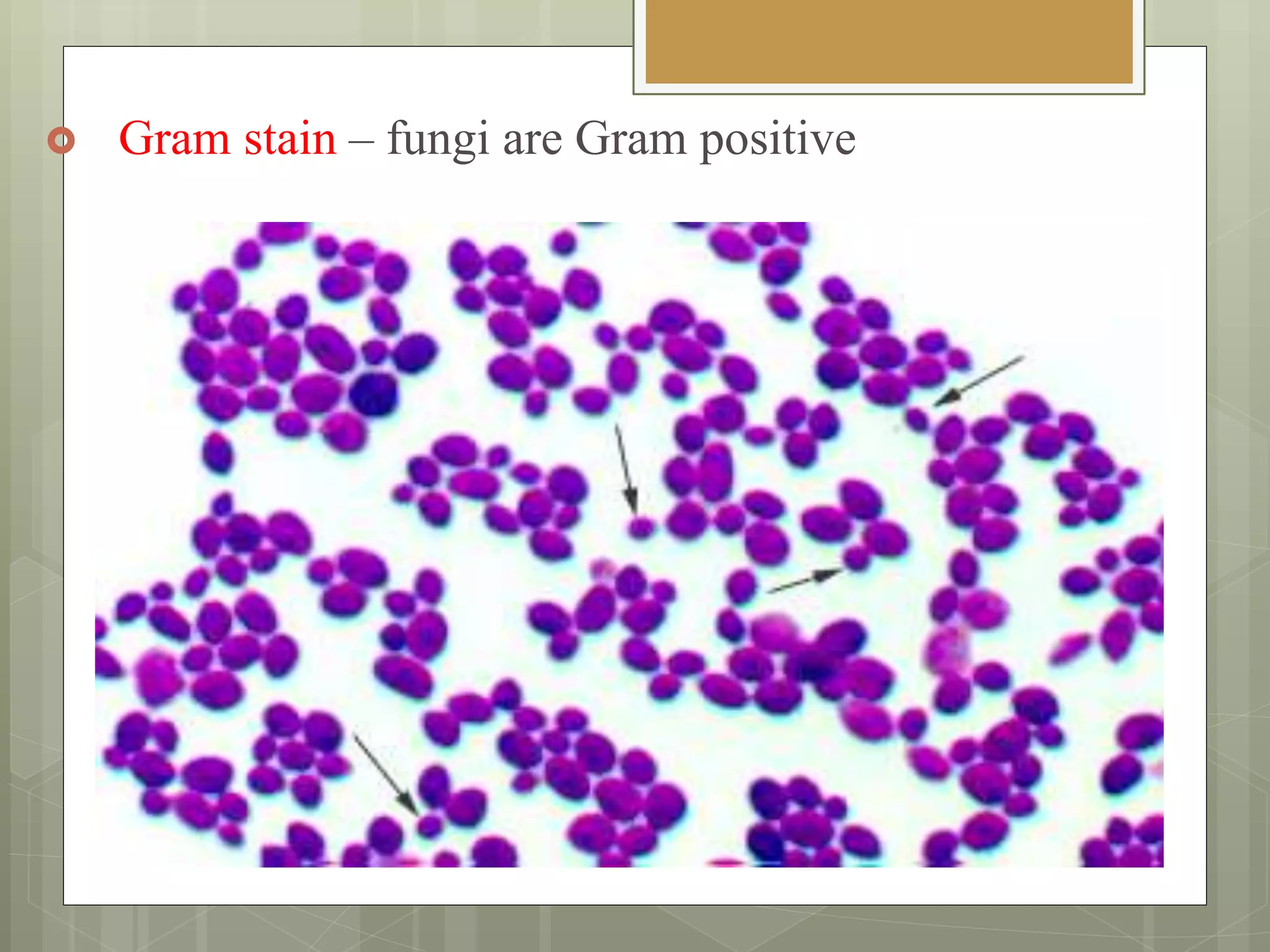 fungal diagnosis.pptx