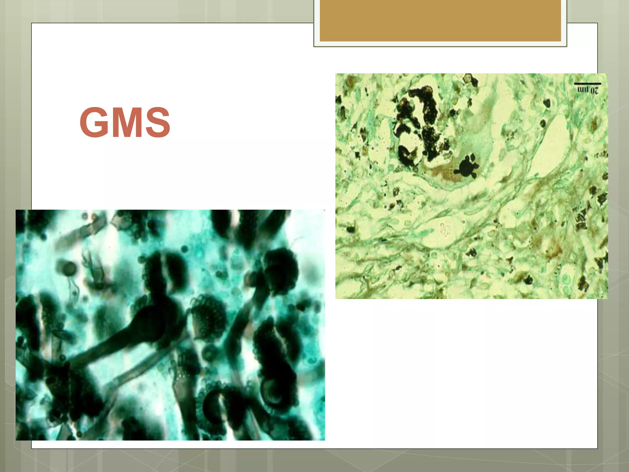 fungal diagnosis.pptx