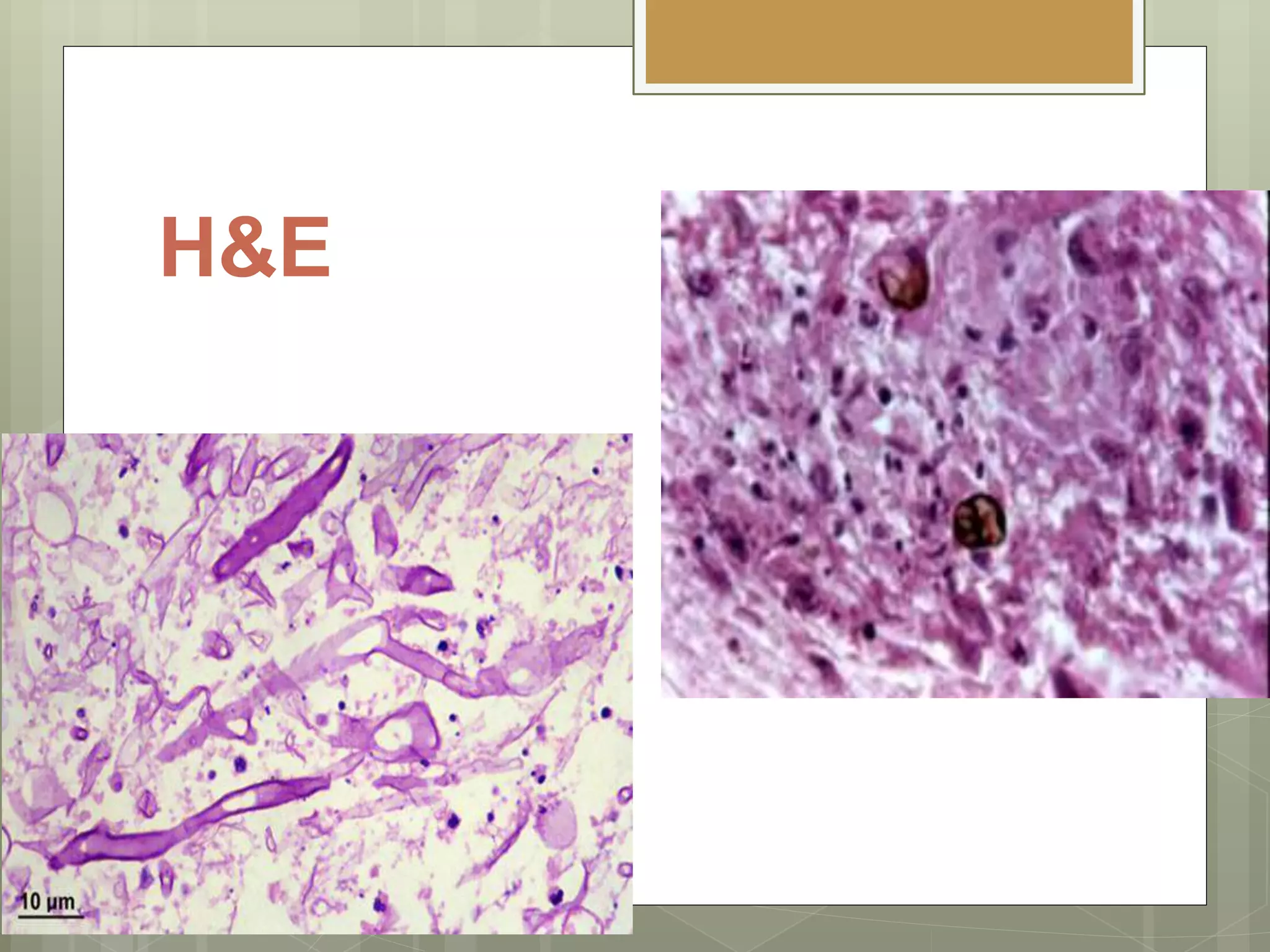 fungal diagnosis.pptx
