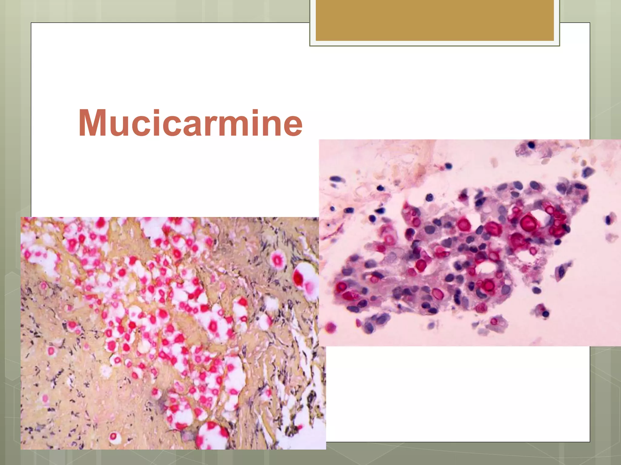 fungal diagnosis.pptx
