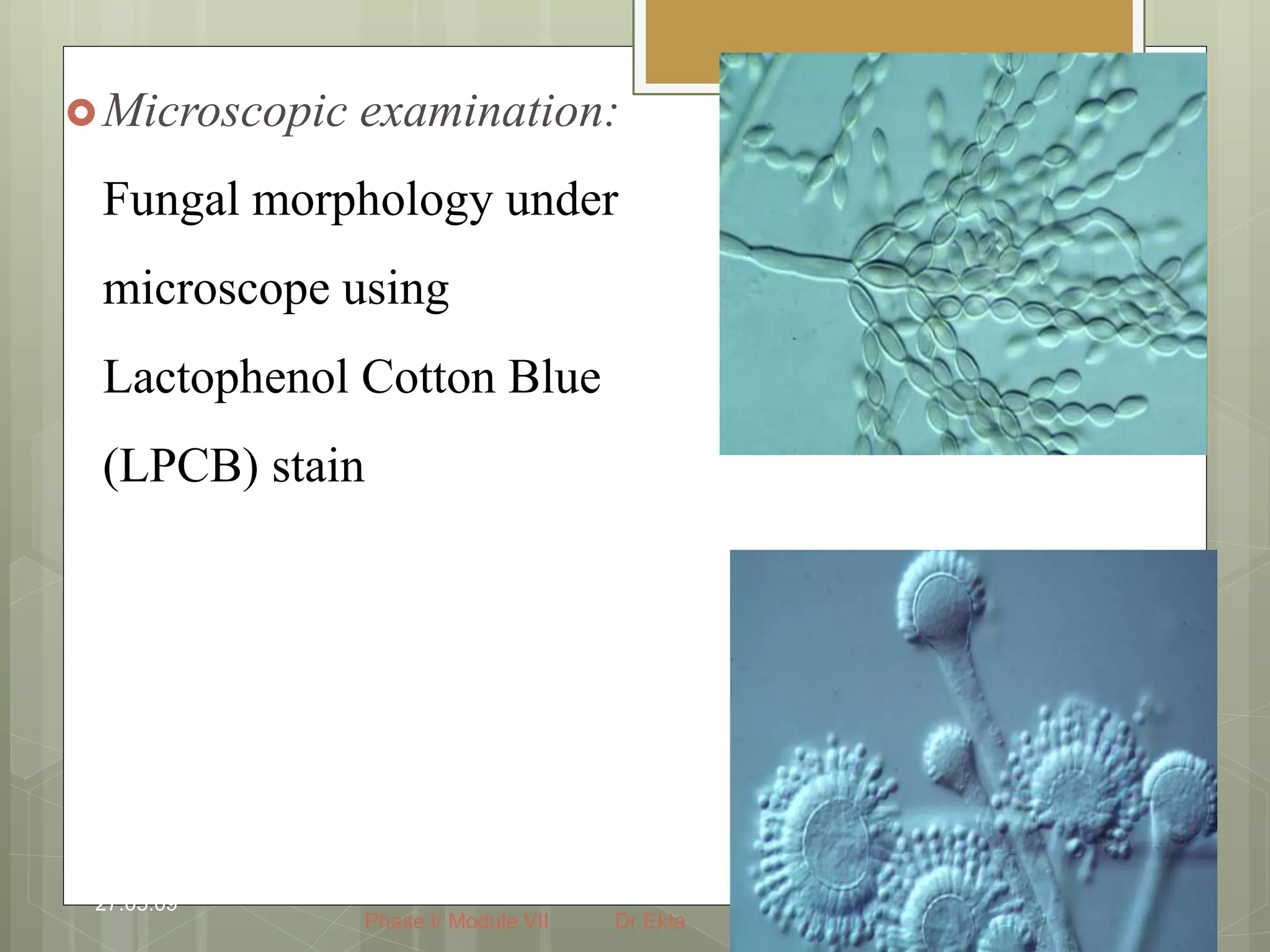 fungal diagnosis.pptx