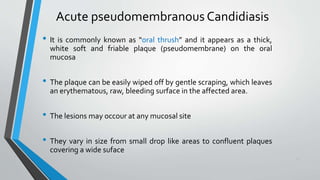 FUNGAL DISEASES in children by dr priyanka.pptx
