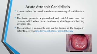 FUNGAL DISEASES in children by dr priyanka.pptx