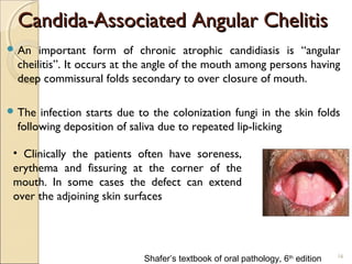 Fungal diseases in children | PPT