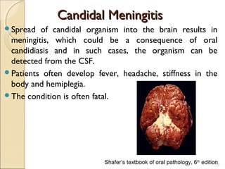Fungal diseases in children | PPT