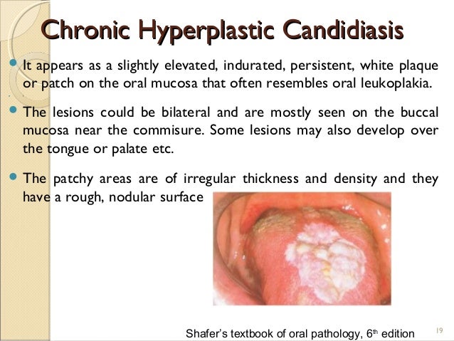 Fungal diseases in children