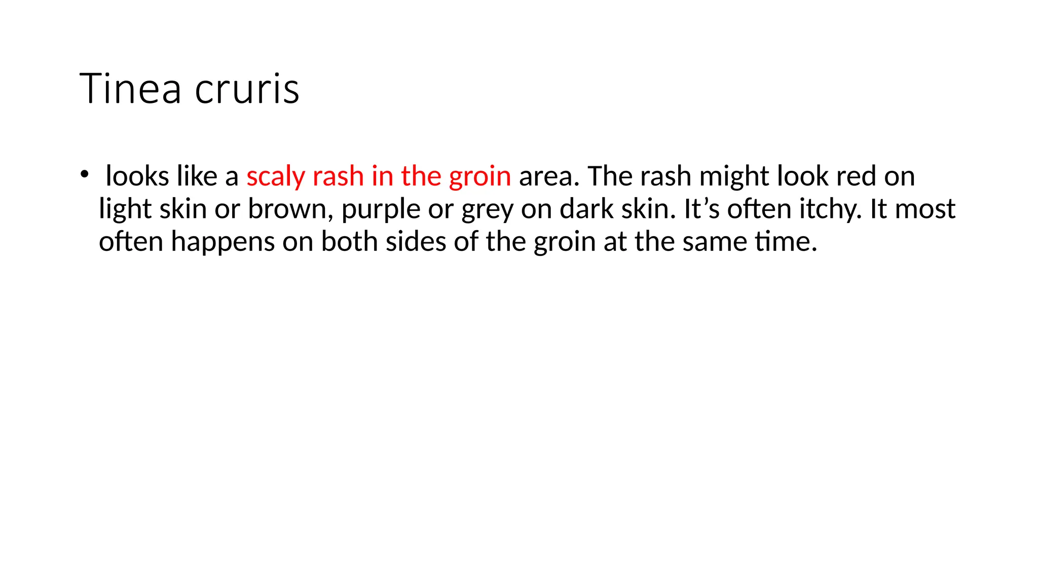 diagnosis and treatment of fungal infection in children .pptx