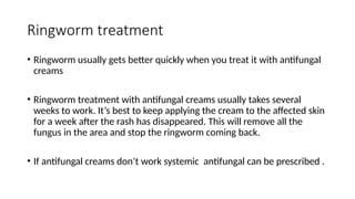 diagnosis and treatment of fungal infection in children .pptx