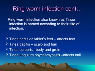 a brief presentation fungal iNFECTION.ppt