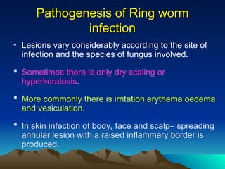a brief presentation fungal iNFECTION.ppt
