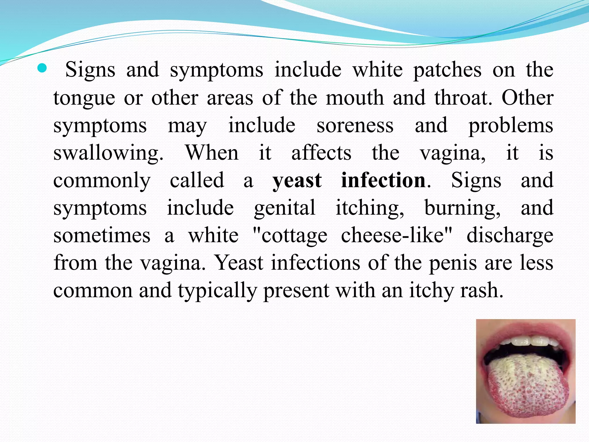 Candidiasis, causes and their treatment | PPTX