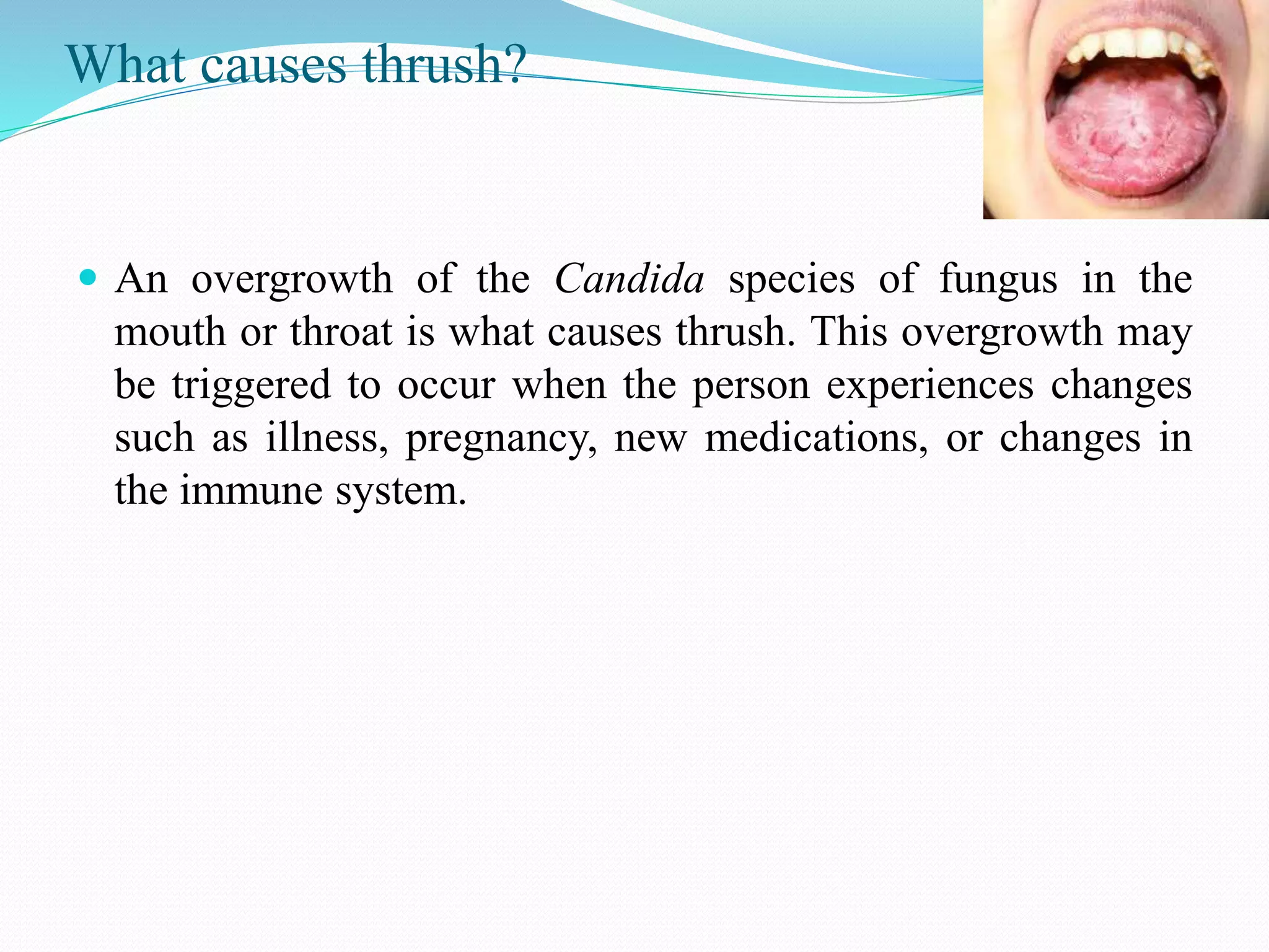 Candidiasis, causes and their treatment | PPTX