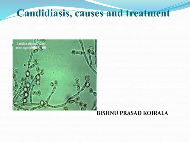 Candidiasis, causes and their treatment | PPTX