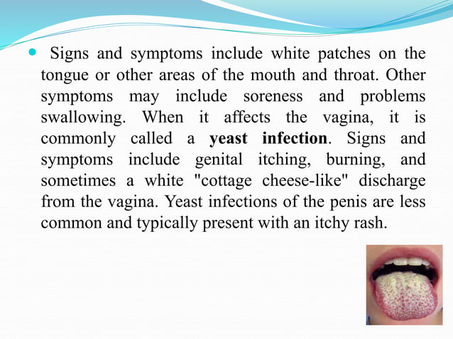 Candidiasis, causes and their treatment | PPTX