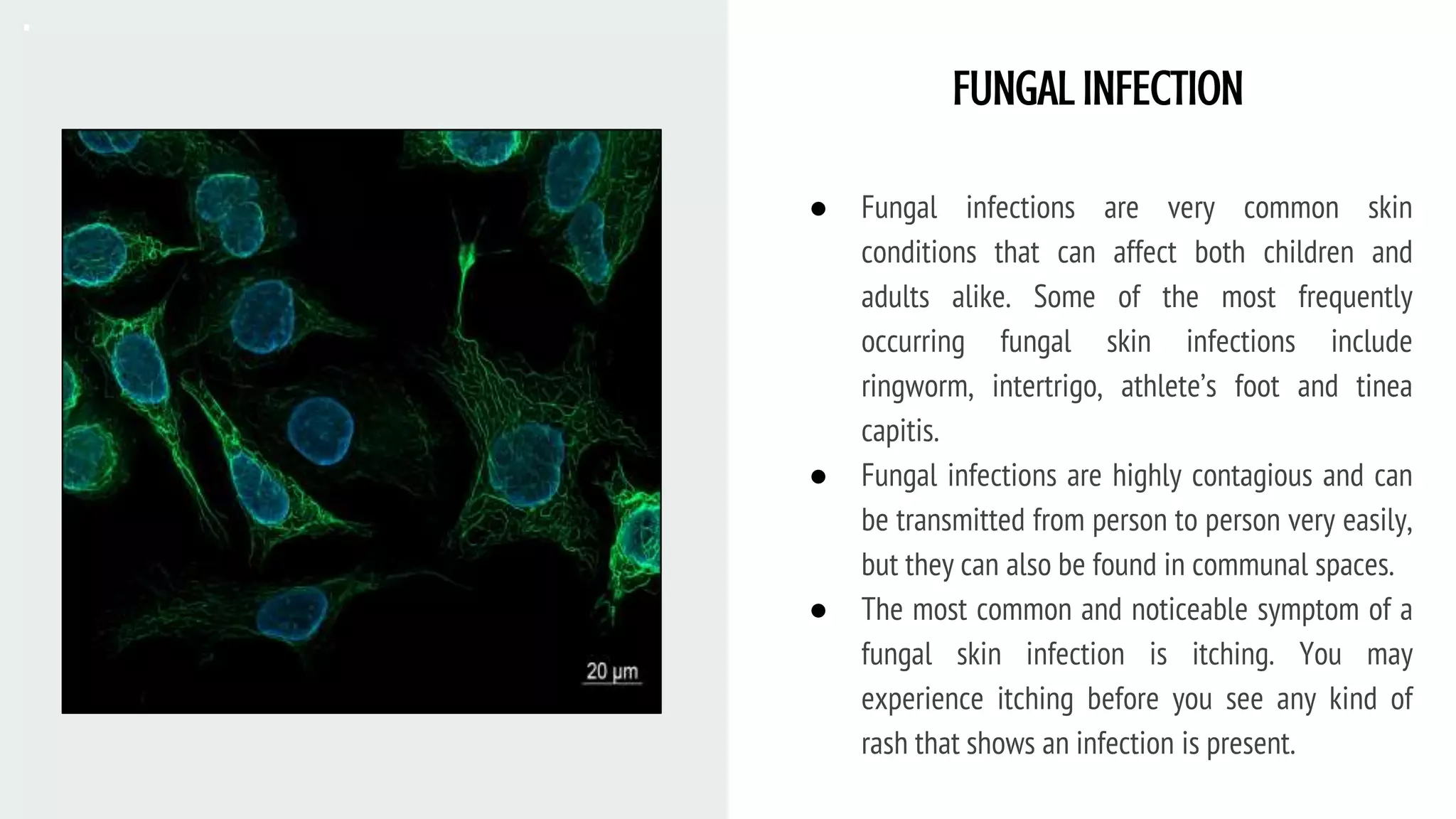 Fungal infection detection | PPTX