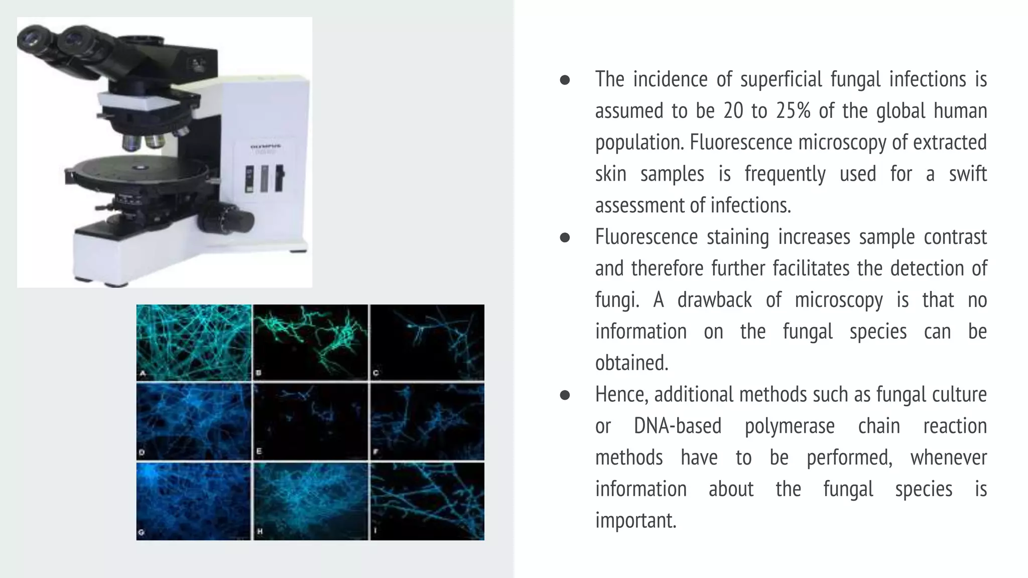 Fungal infection detection | PPTX