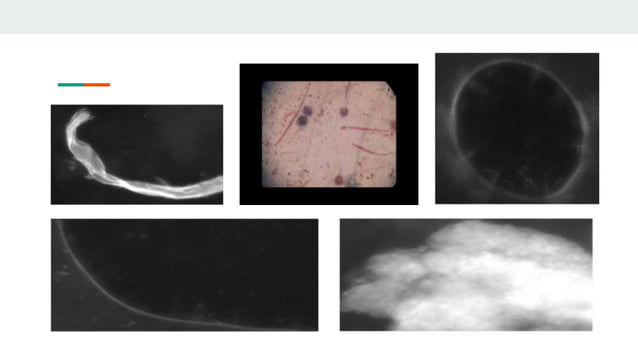 Fungal infection detection | PPT
