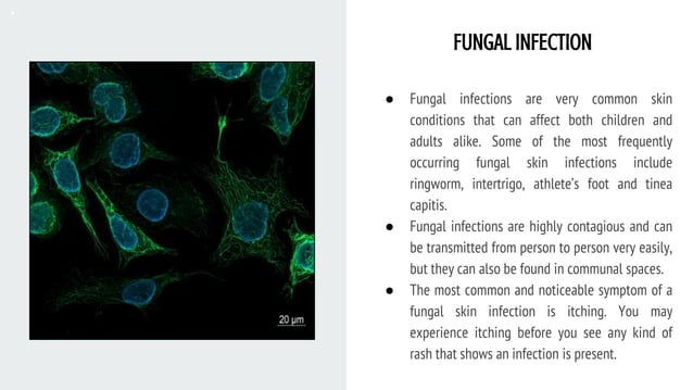 Fungal infection detection | PPT