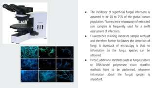 Fungal infection detection | PPTX