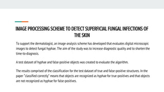 Fungal infection detection | PPTX