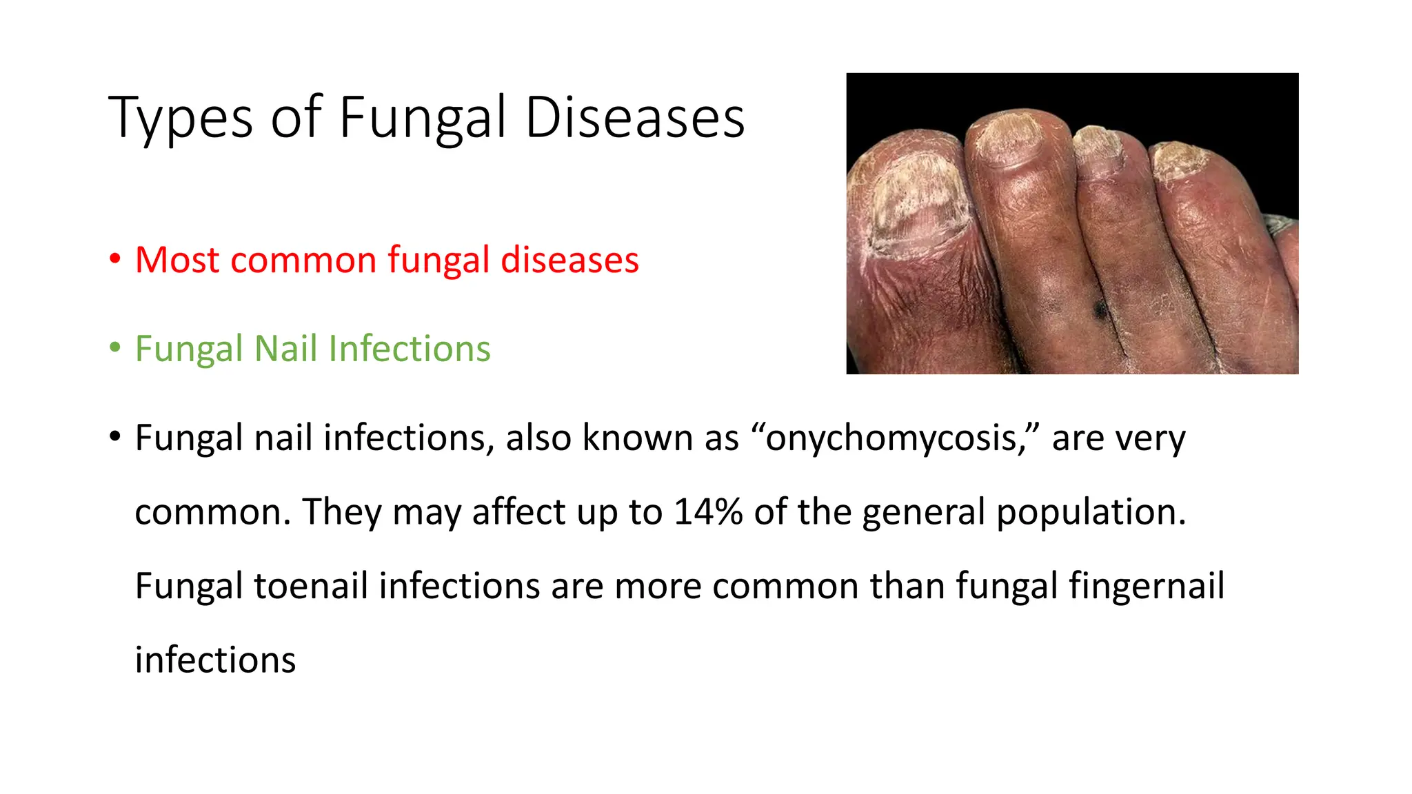 Fungal Infection (pharmacology and rehab) | PPTX