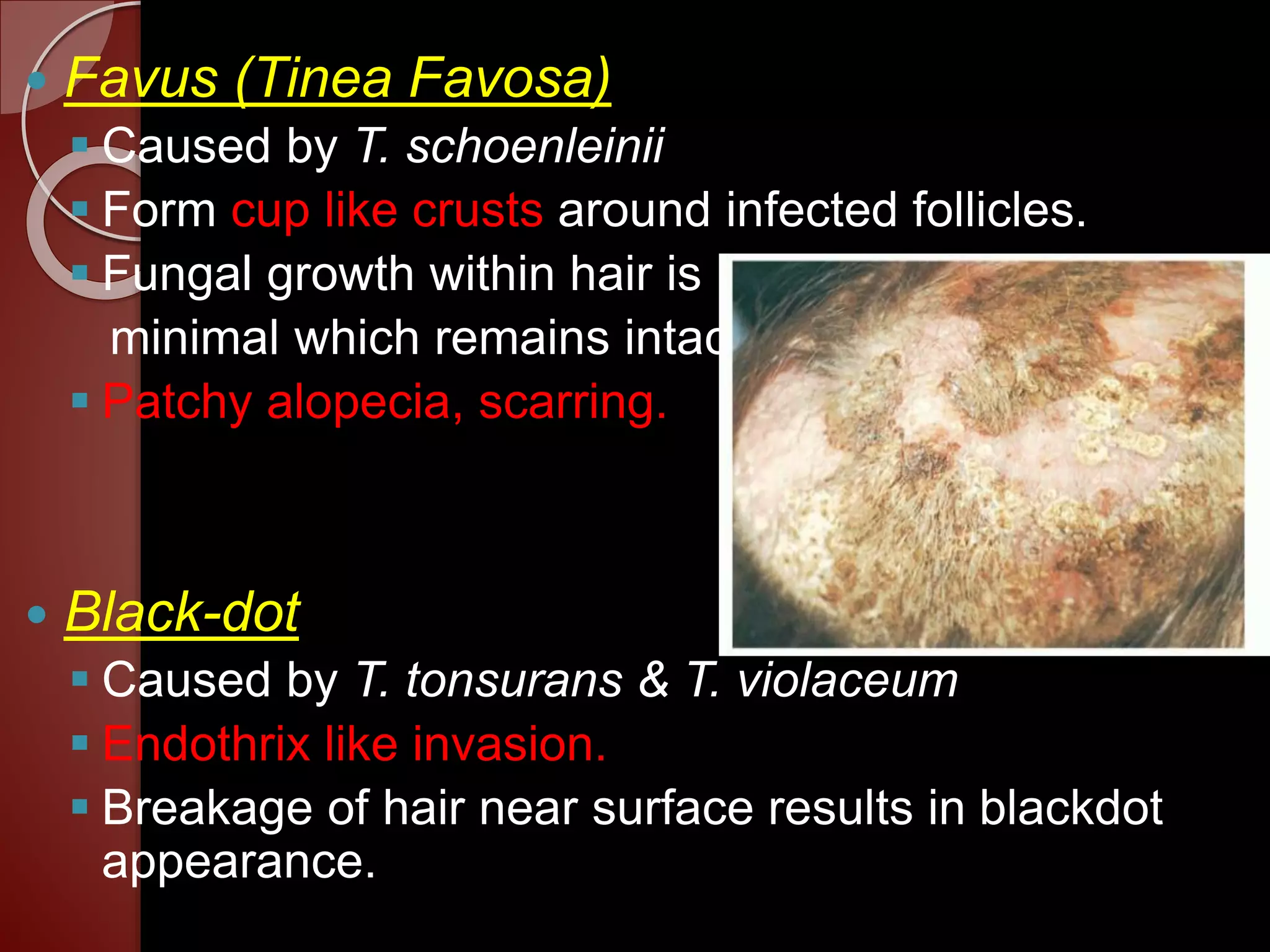 Fungal infection in hair | PPTX