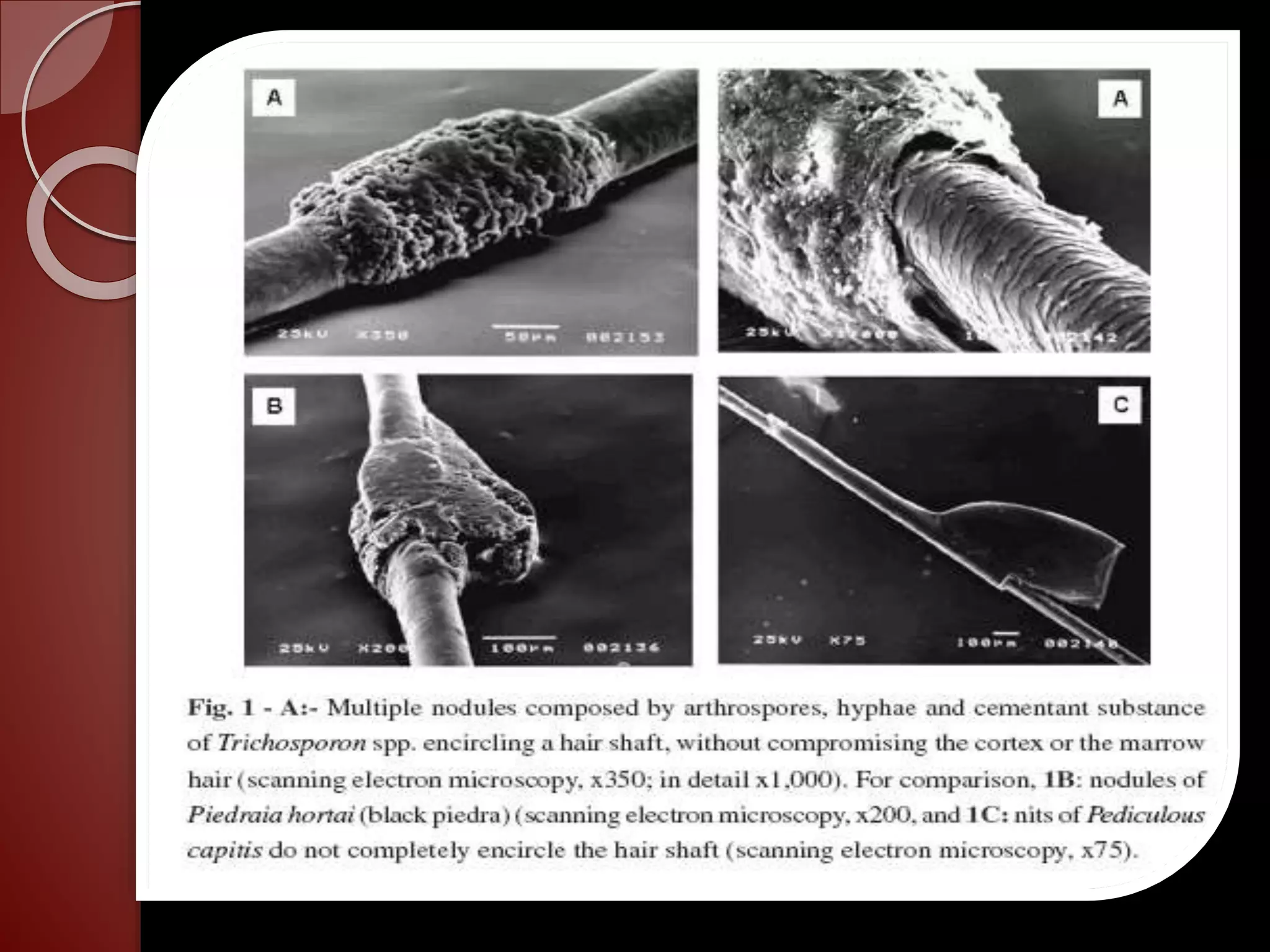 Fungal infection in hair | PPTX
