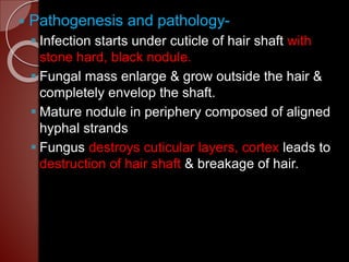 Fungal infection in hair | PPTX