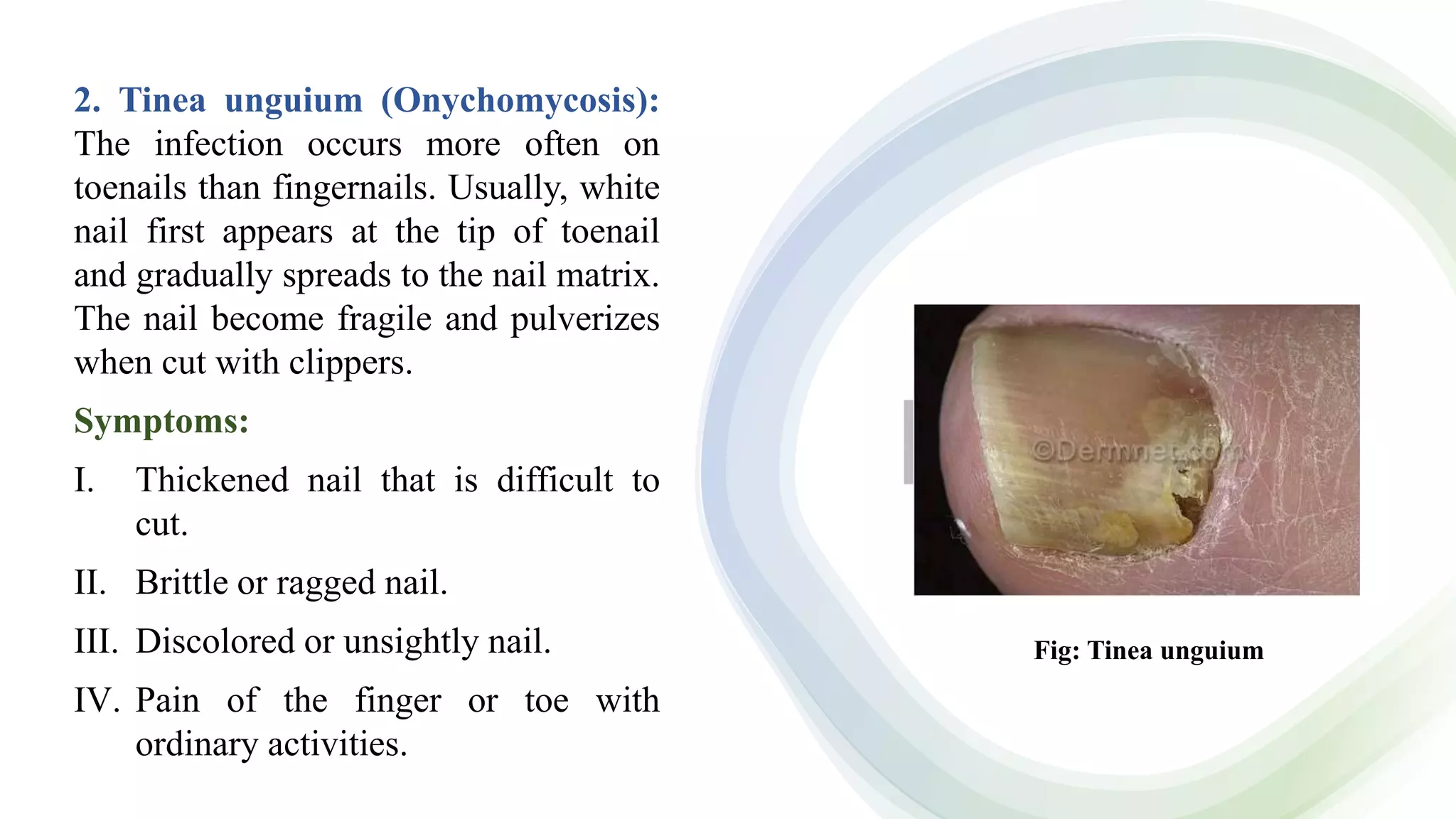 Fungal diseases in humans part 1 | PPTX