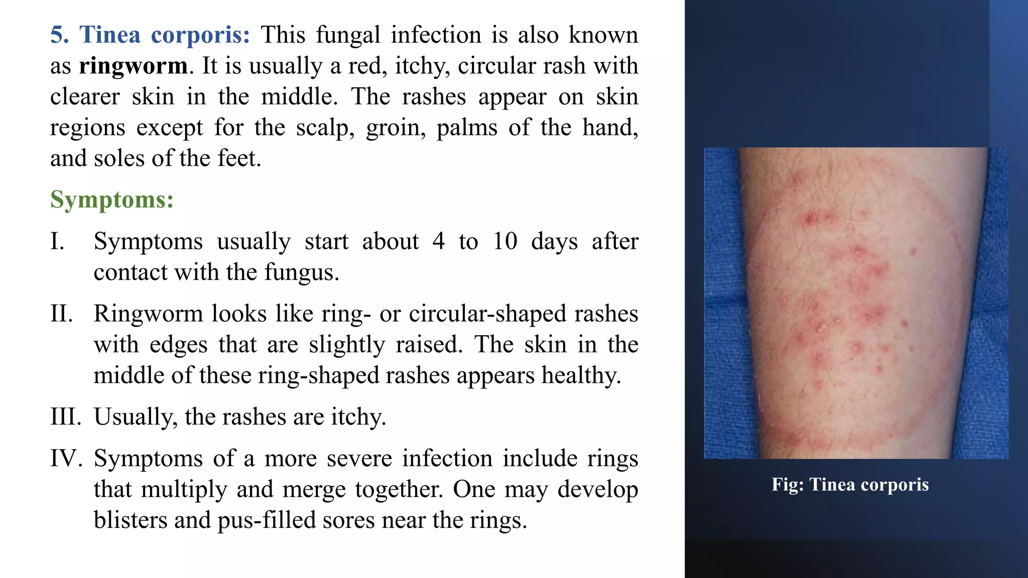 Fungal diseases in humans part 1 | PPTX