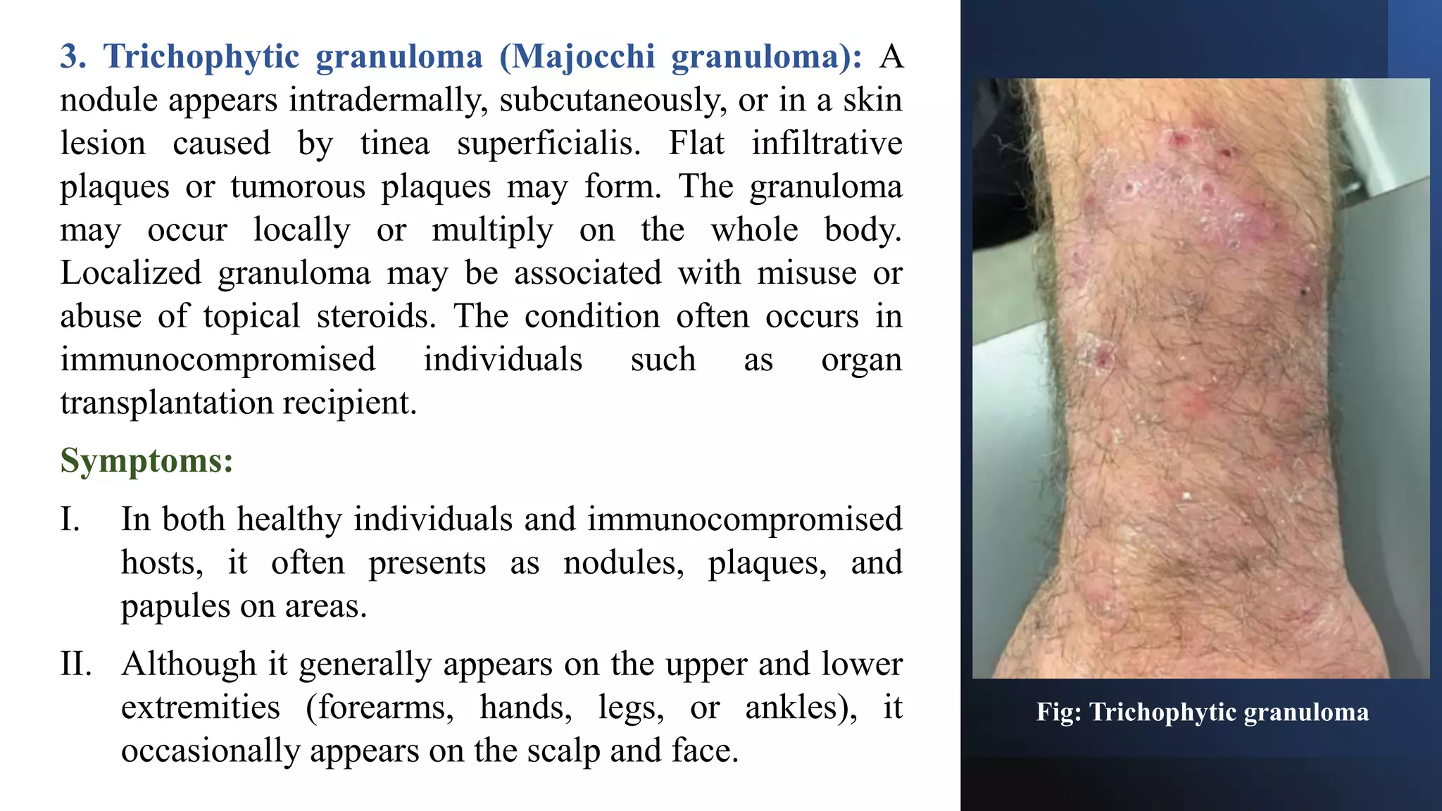 Fungal diseases in humans part 1 | PPTX
