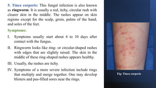Fungal diseases in humans part 1 | PPTX