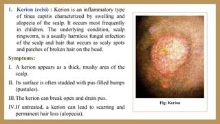 Fungal diseases in humans part 1 | PPTX