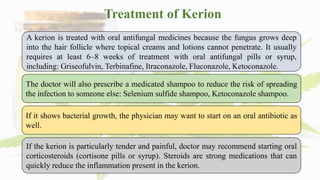 Fungal diseases in humans part 1 | PPTX