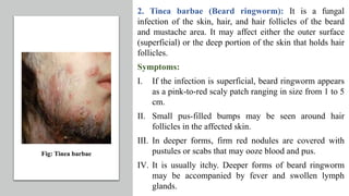 Fungal diseases in humans part 1 | PPTX