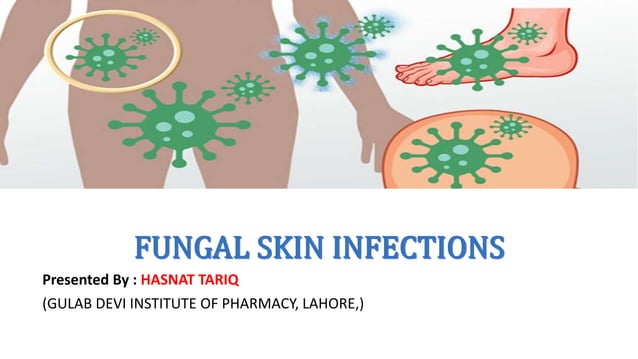 Fungal infection of skin (Dermatophytosis , yeast infection) | PPT