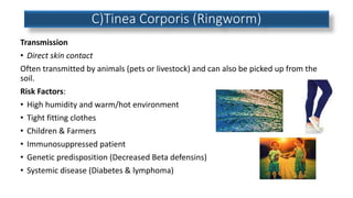 Fungal infection of skin (Dermatophytosis , yeast infection) | PPTX