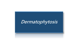 Fungal infection of skin (Dermatophytosis , yeast infection) | PPTX
