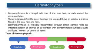 Fungal infection of skin (Dermatophytosis , yeast infection) | PPTX