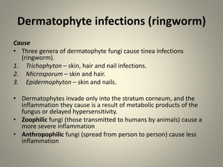 Fungal infections | PPTX