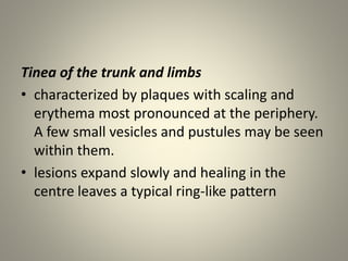 Fungal infections | PPTX