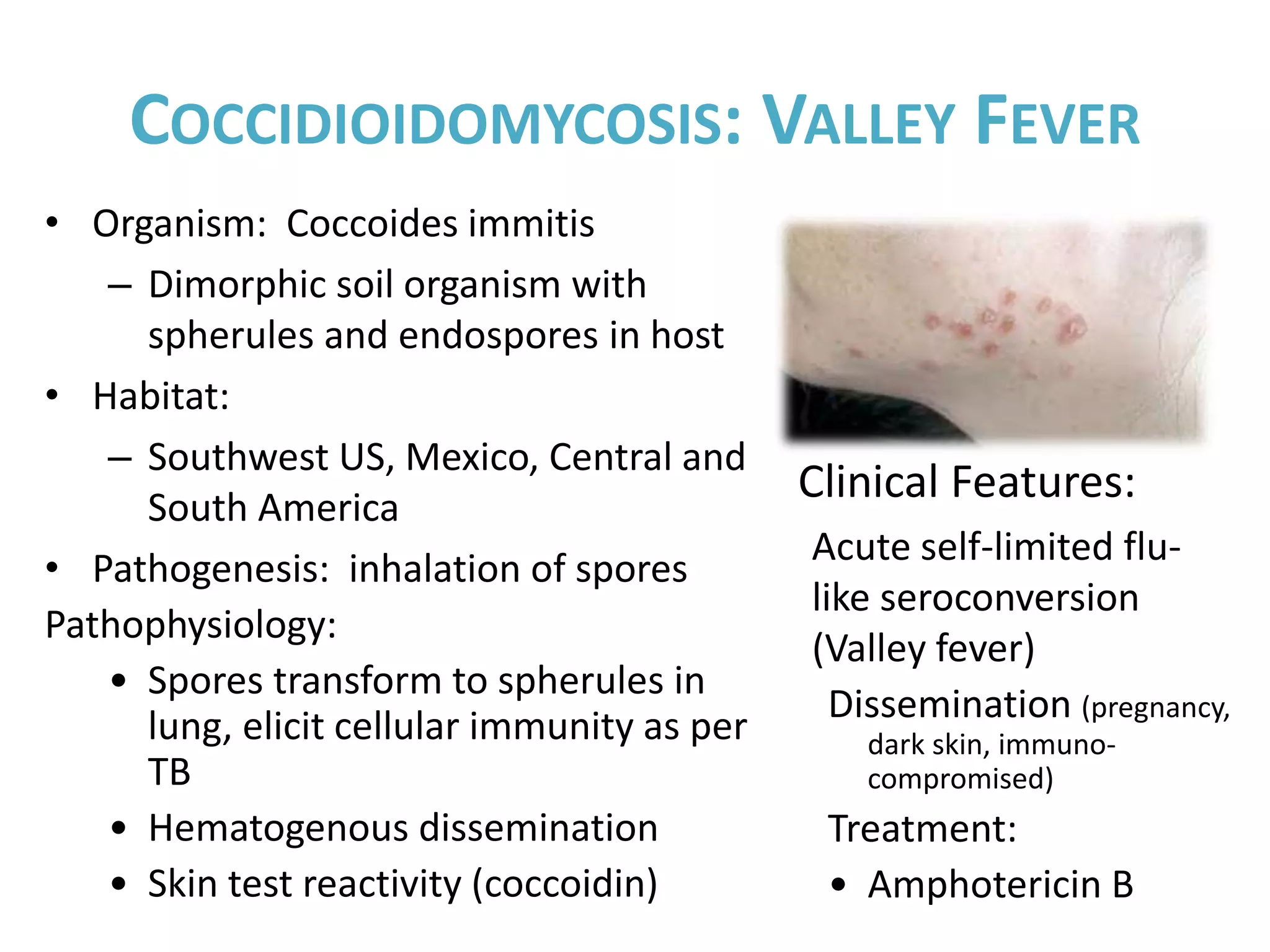 Fungal infections | PPTX