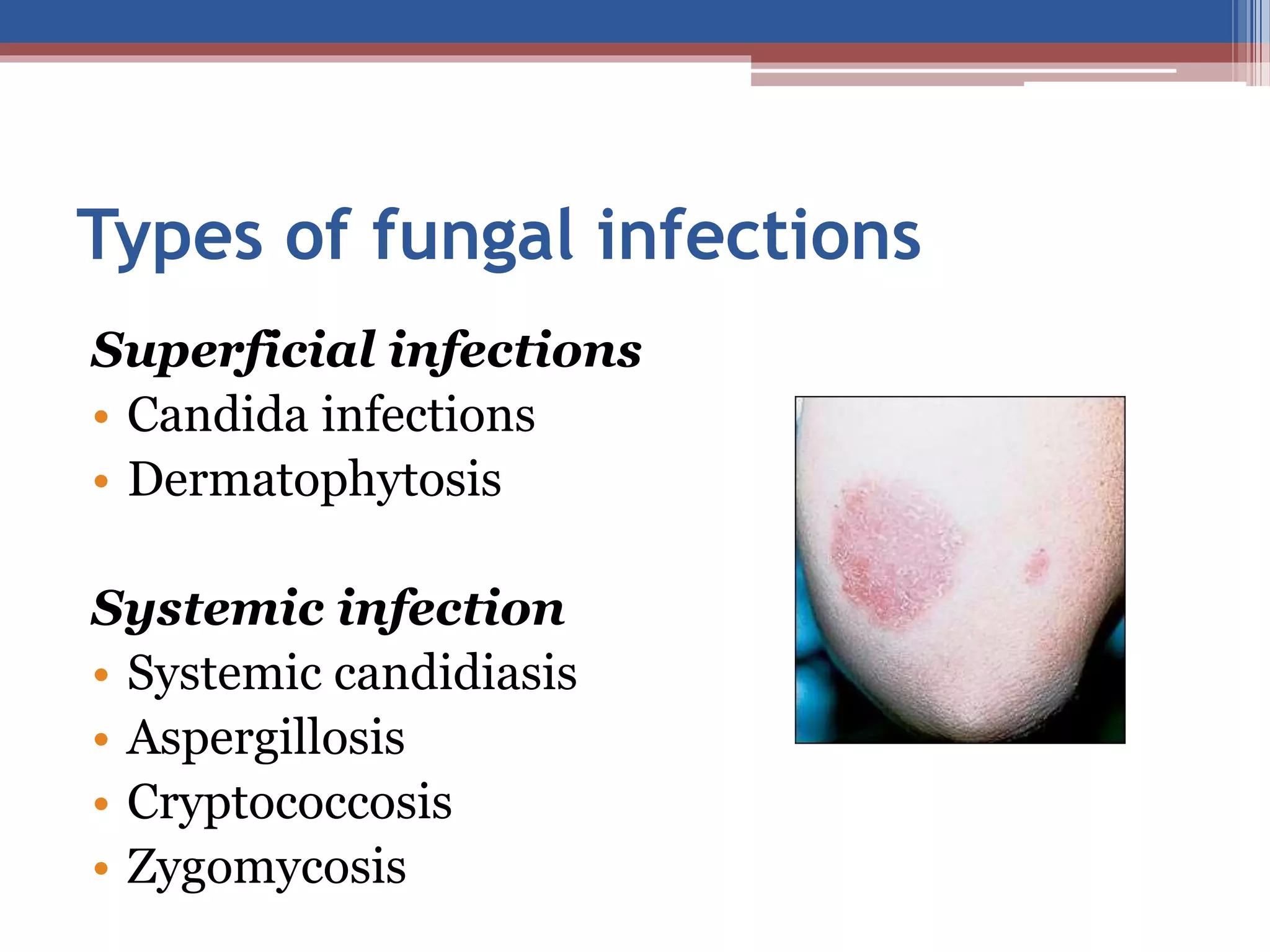 Fungal infections | PPTX