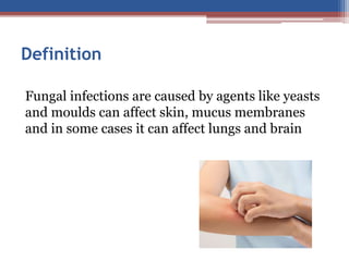 Fungal infections | PPT