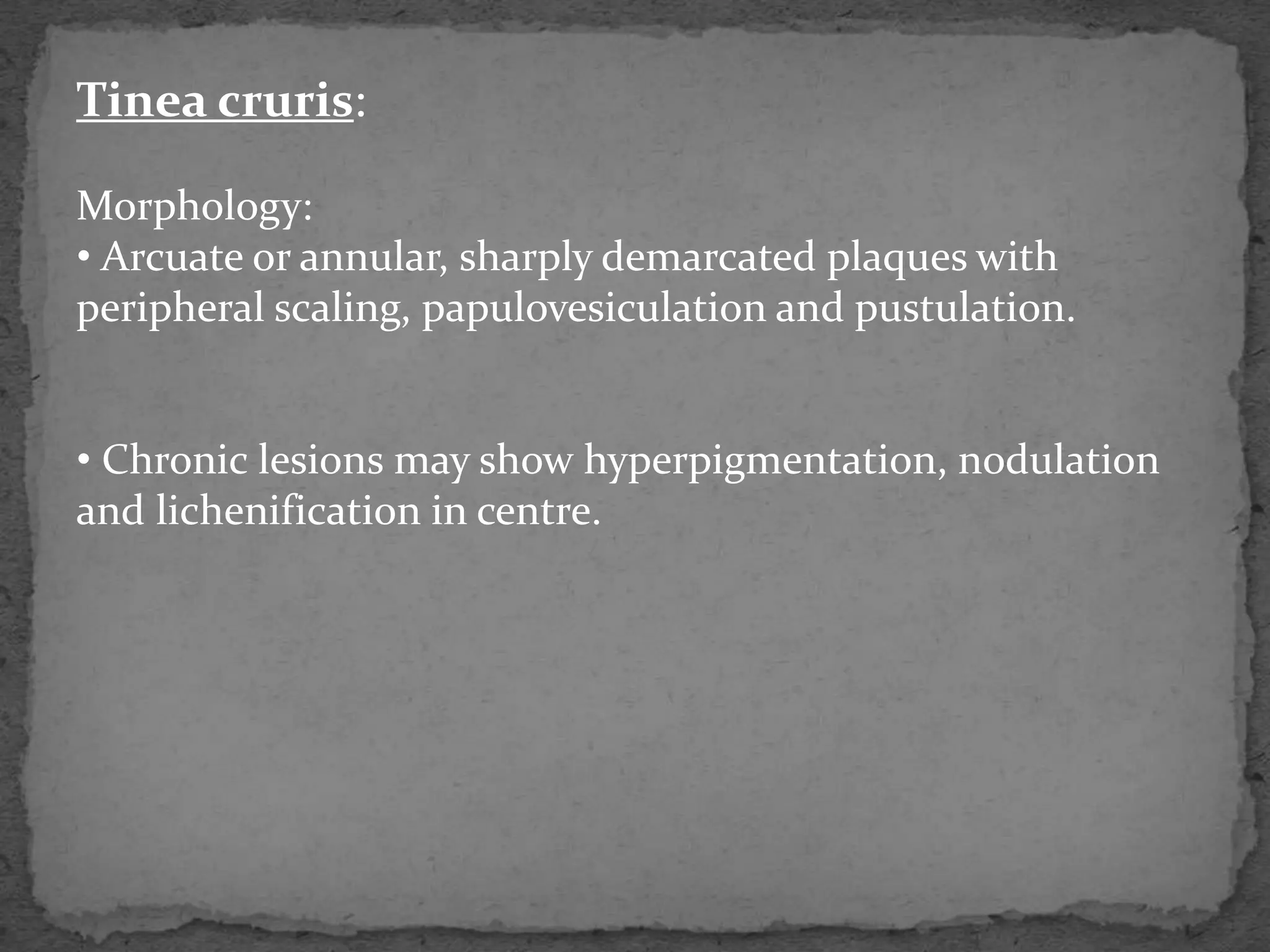 Fungal Infections.pptx