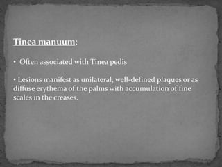 Fungal Infections.pptx